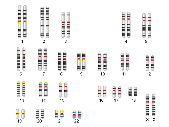 Explore your genome - The solution - OpenLearn - Open University