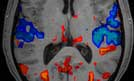 How FMRI works - OpenLearn - Open University